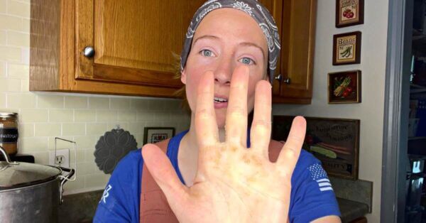 How to Get Rid of Squash Hands - Food Prep Guide - Preserving & Storing ...